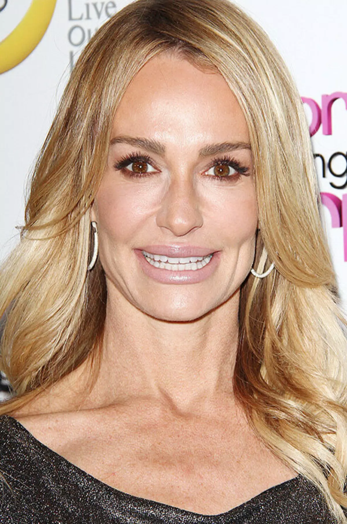 De Demi Moore a Dana Borisova: 10 estrelas, cuxas caras son afogadas en Botox 2114_9