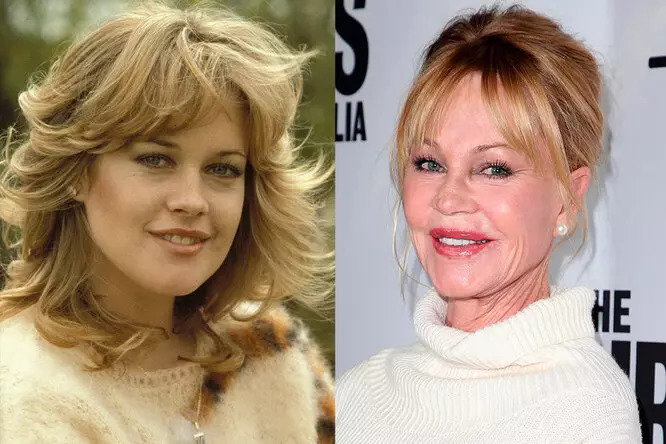 Scary beautiful: 10 stars who have become victims of plastic surgery 21529_5