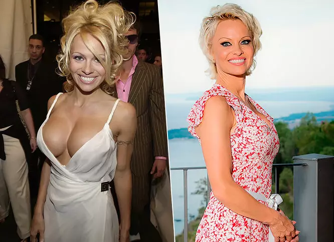 Jennifer Connelly, Pamela Anderson och andra stjärnor, som minskade bröstet 38907_4