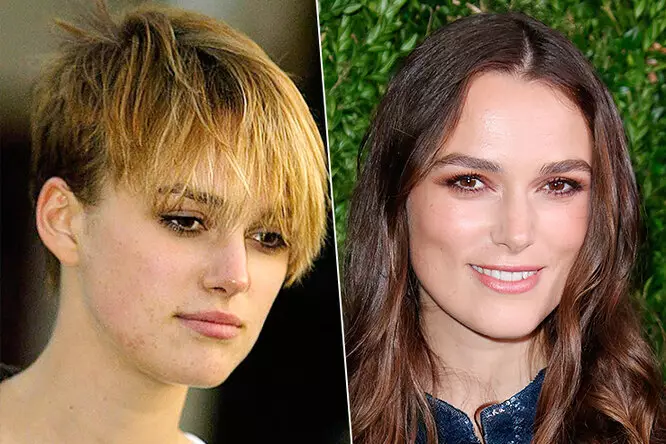 Victoria Beckham, Rihanna, Keira Knightley dan bintang-bintang lain yang mengalahkan Jerawat 43280_1