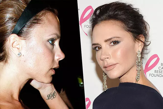 Victoria Beckham, Rihanna, Keira Knightley dan bintang-bintang lain yang mengalahkan Jerawat 43280_2