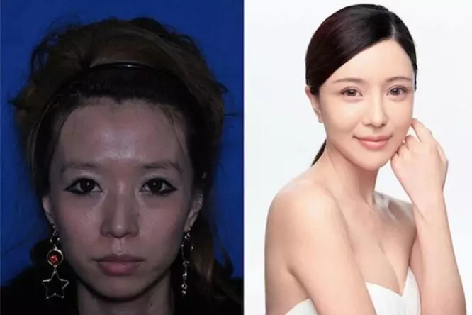 Piękno Azjatycka: Jaka chirurgia plastyczna robi orientalne dziewczyny 43740_2