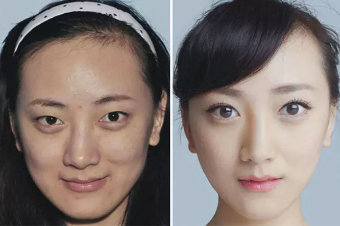 Piękno Azjatycka: Jaka chirurgia plastyczna robi orientalne dziewczyny 43740_3