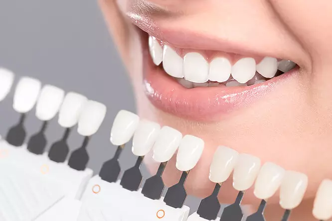 White White: 5 most effective ways of teeth whitening 44432_3