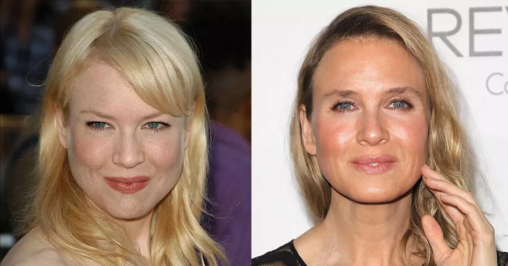 Rene Zellweger, Donatella Versace eta plastiko arrakastatsuak izan ez zituzten beste izar batzuk