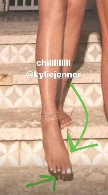 Kylie Jenner alielezea kuwa si kwa kidole chake cha 