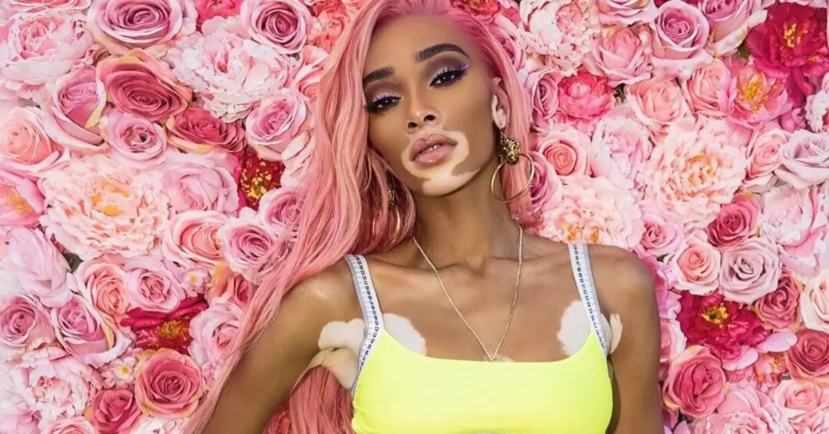 Winnie Harlow, Miley Cyrus and Cardi Bee: Stars who are masterfully worn neon