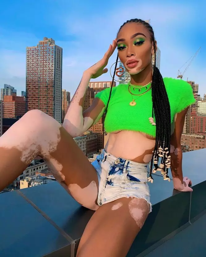 Winnie Harlow, Miley Cyrus and Cardi Bee: Stars who are masterfully worn neon 60727_1