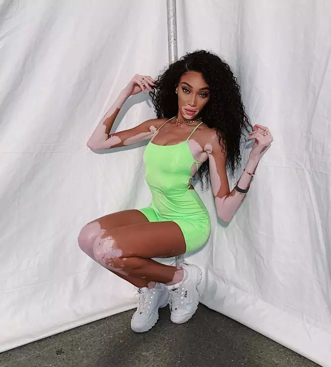 Winnie Harlow, Miley Cyrus and Cardi Bee: Stars who are masterfully worn neon 60727_2