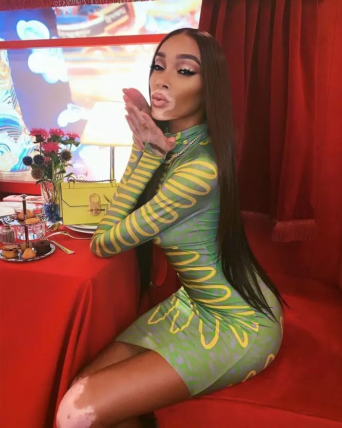 Winnie Harlow, Miley Cyrus and Cardi Bee: Stars who are masterfully worn neon 60727_3