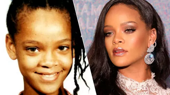 Rihanna, Beyonce, Kate Hudson and other lopouhi stars that made plastic 60867_4