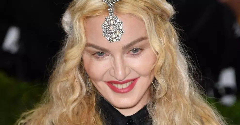 Madonna, Drew Barrymore and other stars with yellow teeth