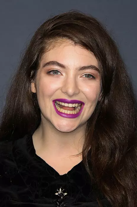 Madonna, Drew Barrymore and other stars with yellow teeth 60930_2