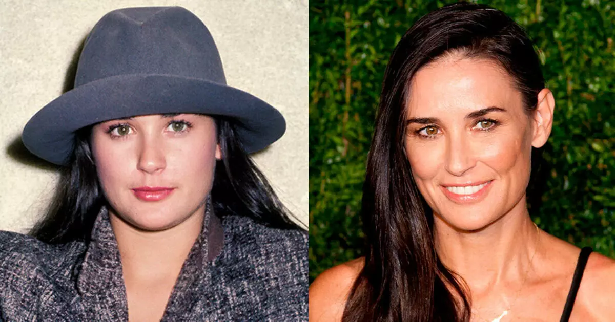 Demi Moore and 7 more stars, which changed the shape of the chin and all his life