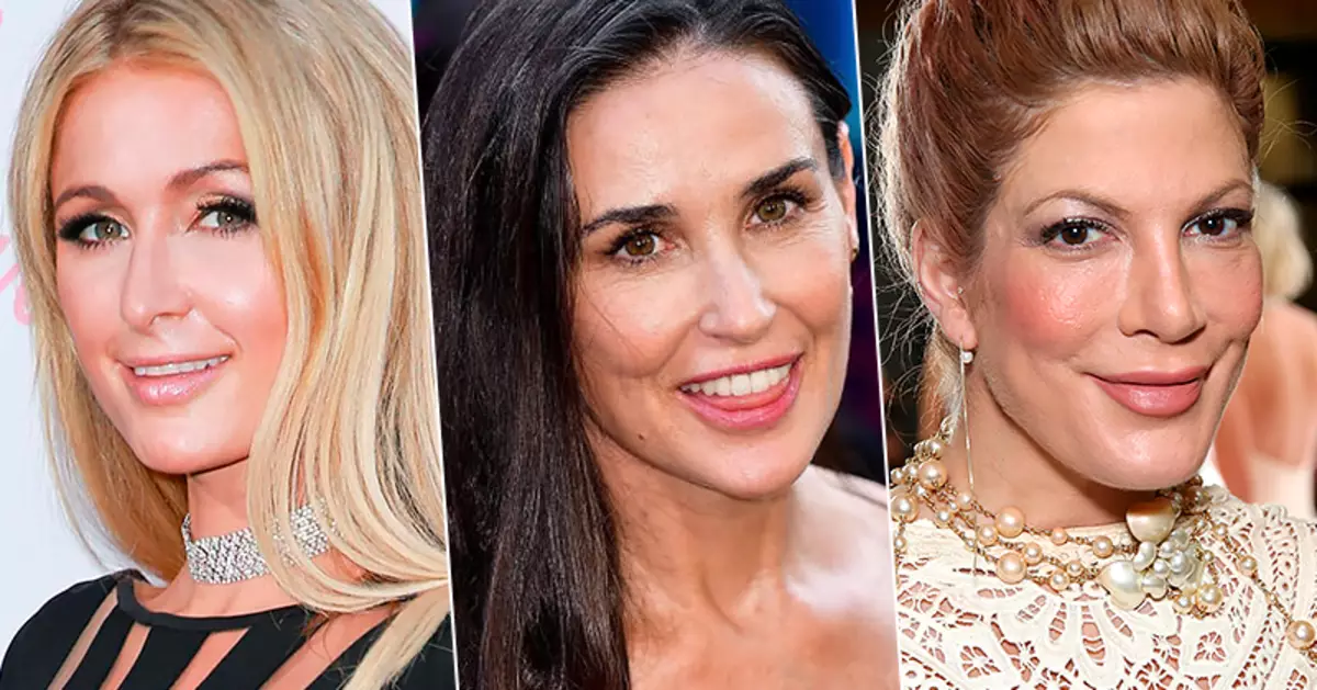 The best is a good enemy: stars whose noses spoiled rhinoplasty