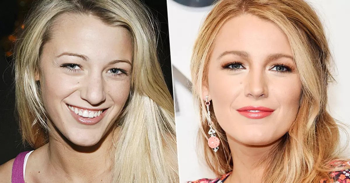 Blake Lively, Gwyneth Paltrow and 13 more celebrities, which redested the nose