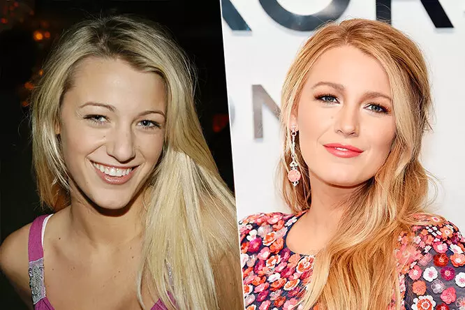 Blake Lively, Gwyneth Paltrow and 13 more celebrities, which redested the nose 65441_1