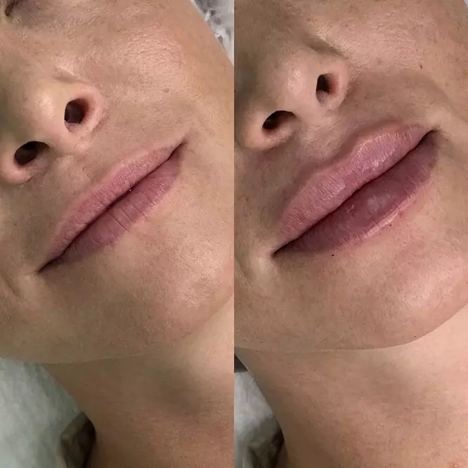 Natalia Friske veranderde de vorm van de lippen - en nu is de gelijkenis met de sterzus bijzonder merkbaar geworden 7458_1
