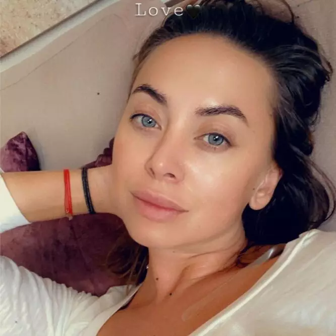 Natalia Friske changed the shape of the lips - and now its similarity with the star sister has become especially noticeable 7458_2