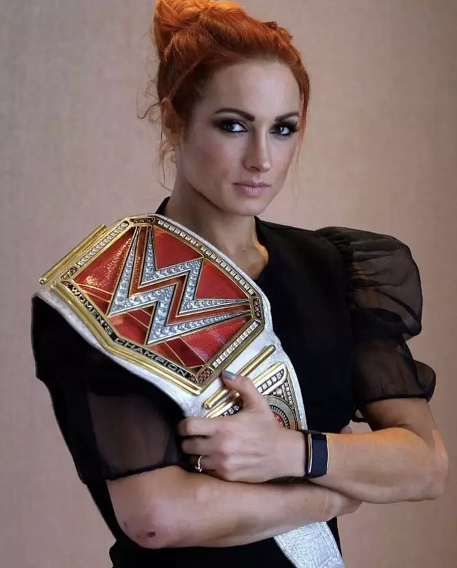 Atrapado con un sueño: el famoso campeón luchador Becky Lynch está esperando al primogénito. 7719_2