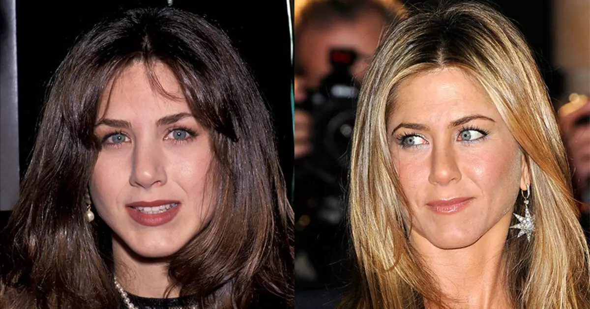 Début Transformation: Plastique Qu'est-ce qui est devenu le premier pour Aniston, Beckham, Zverev, Shishkova et d'autres étoiles